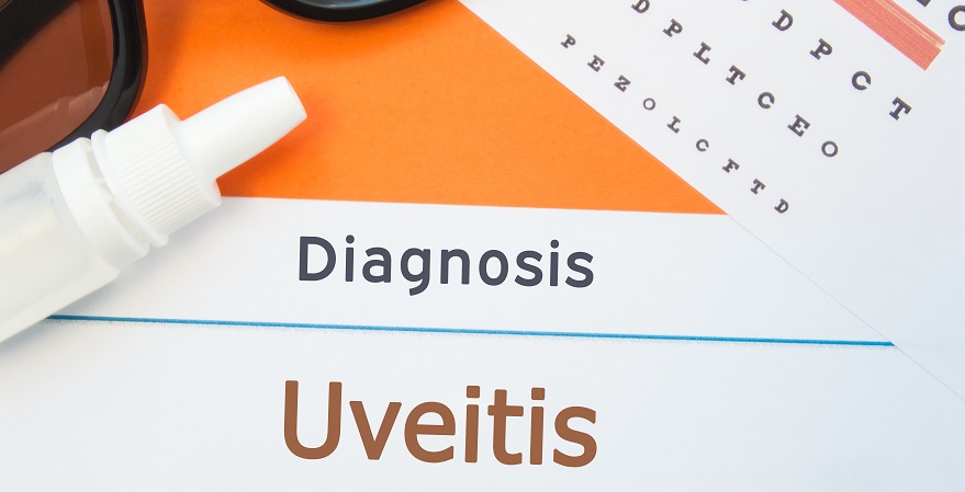Uveitis Eye Inflammation | Symptoms, Causes, Diagnosis & Treatment